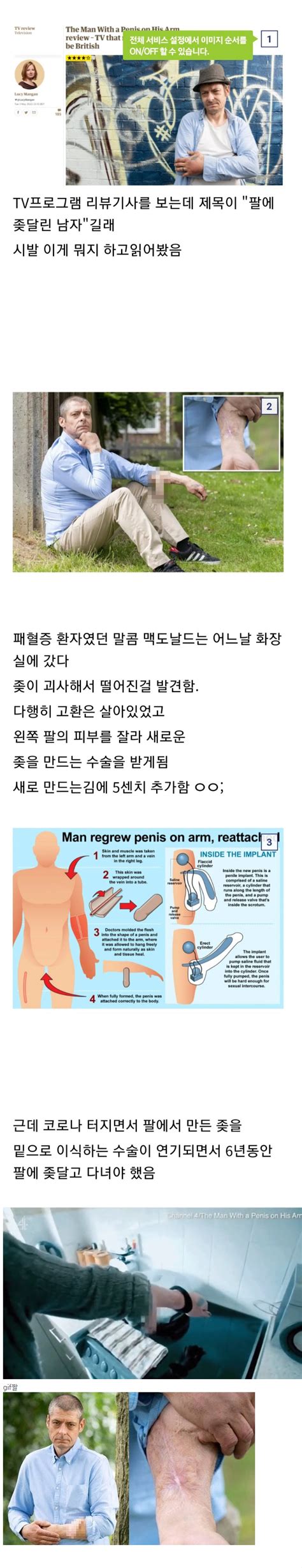팔에 ㅈ달린 남자  유머움짤이슈 에펨코리아