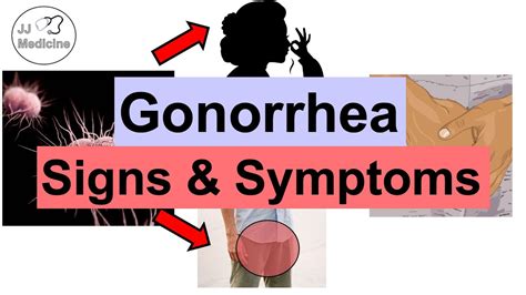 Gonorrhea Know The Warning Signs Symptoms And How To Possible Signs