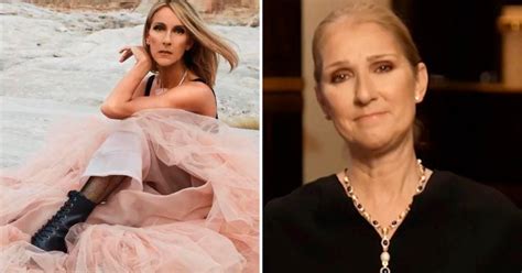 Choroba Ju Mení Na Sochu Speváčke Celine Dion Diagnostikovali Lekári Vzácnu Neurologickú