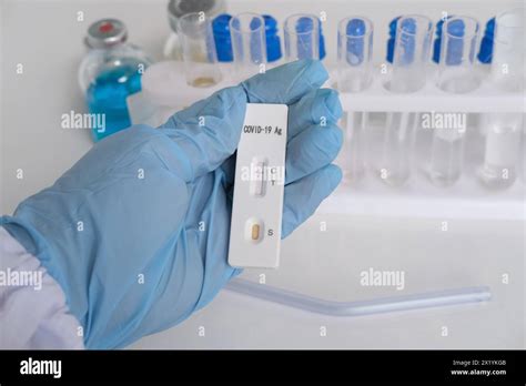 Antigenic Test Cassette Glass Test Tubes With Reagents Conducting A