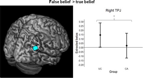Rtpj Figure 4 Oxytocin Effects On The Resting State Mentalizing Brain Network Springerlink
