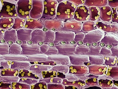 Xylem Under Microscope