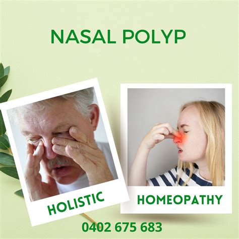 Agimary Joseph On Linkedin Nasal Polyp A Nasal Polyp Is The Non