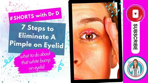 Can You Get Pimple On Your Eyeball At Jade Haylen Blog
