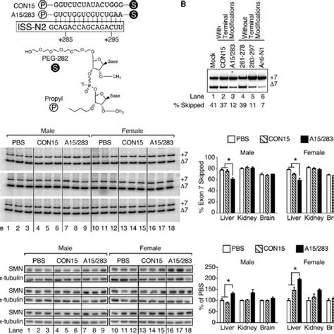 Changes In Hammersmith Functional Motor Scale Expanded HFMSE Scores Download Scientific