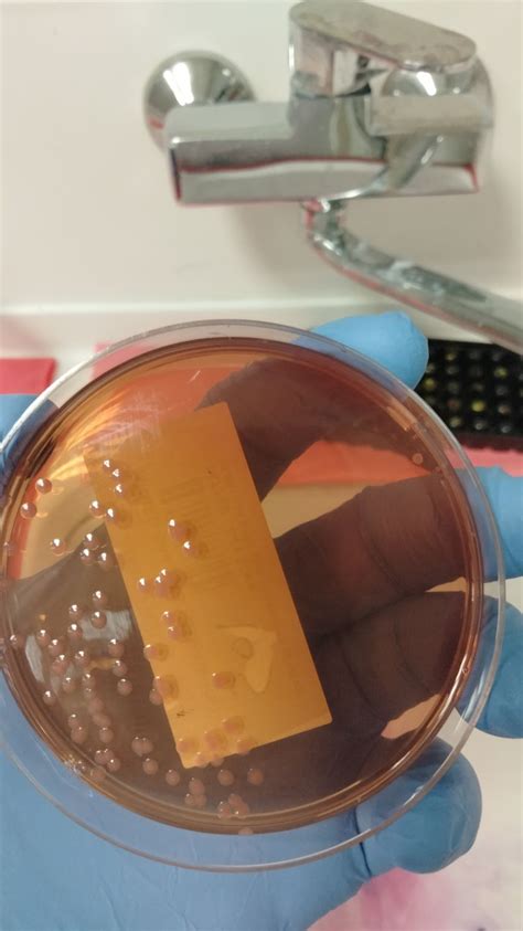 Amr Magdy On Linkedin Achromobacter Xylosoxidans Lovly Micro