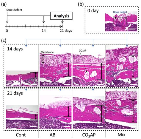 A Tibia Defect And Preparation Of Autogenous Bone A Hole Was Created Download Scientific