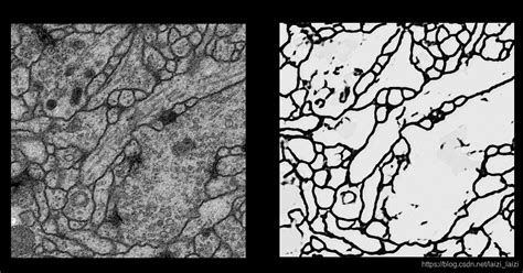 基于pytorch编写unet进行细胞结构分割细胞分割pytorch Csdn博客 基于pytorch编写unet进行细胞结构分割细胞分割pytorch Csdn博客
