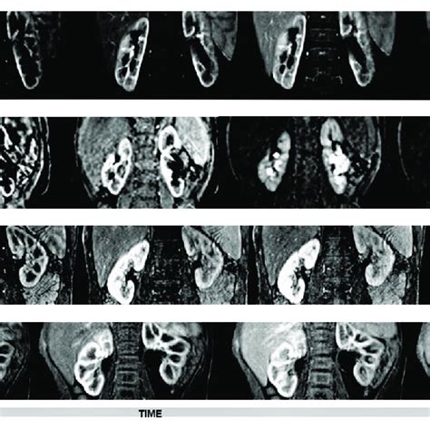 Examples Of Evaluation Of Quality On The Dynamic Sequence In Every