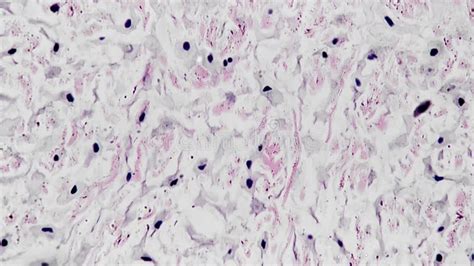 Dense Connective Tissue Of Human Whole Mount Filmed Under Microscope