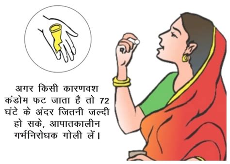 कंडोम Condom क्या है कंडोम कैसे प्रयोग करना चाहिए कंडोम का प्रयोग बैकअप विधि की तरह किन