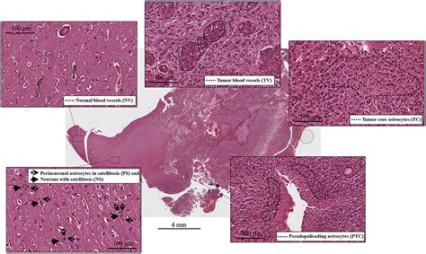 Frontiers Laser Capture Microdissection And Rna Seq Analysis High Sensitivity Approaches To