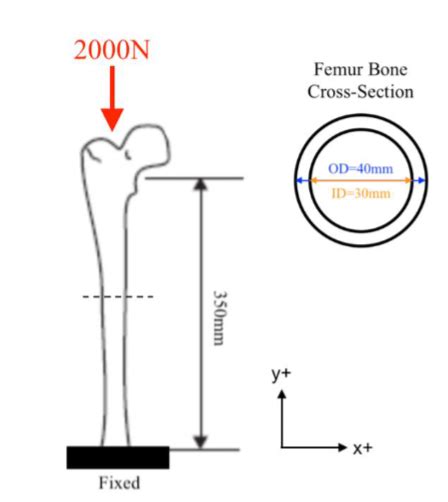 Solved A 350mm Long Femur Bone With A Youngs Modulus Of E