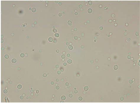 Saline Mount Of Peritoneal Dialysate Showing Budding Yeast Growing On