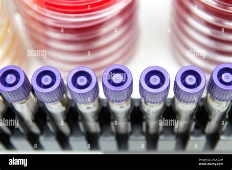 Microbial Sample Transport Swabs These Standard Containers Are Used To