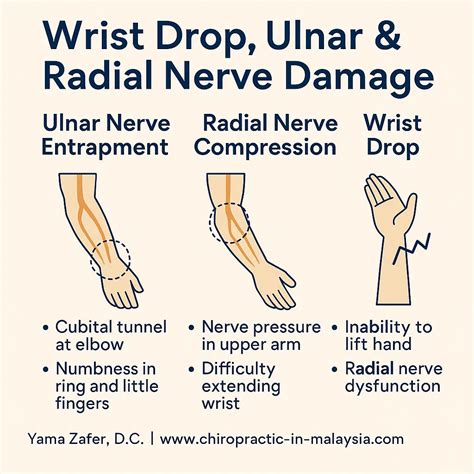 Radial An Ulnar Nerve Motor Testing Protocols