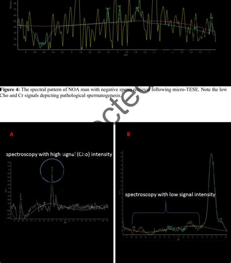Comparison Of A Spectroscopy With A High A And Low B Signal Download Scientific Diagram