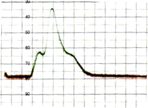 Gel Chromatography Of Protein From Grass Pea Vine Seeds Download