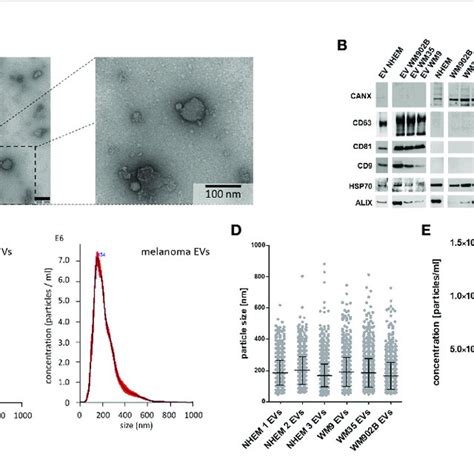 Isolation And Characterization Of Extracellular Vesicles A