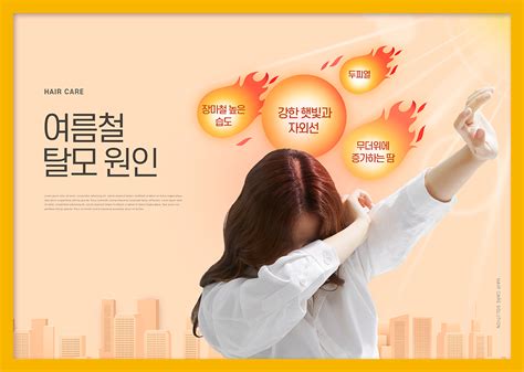 여름철 자외선 탈모의 원인이 되기도 건강검진정보