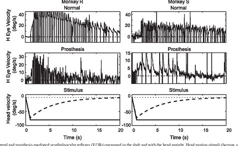 figure 1 from spatial and temporal properties of eye movements produced