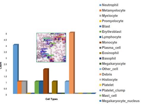 Roi Detection” And Cell Detection And Classification” In Bone Marrow