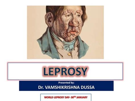 World Leprosy Daypptx