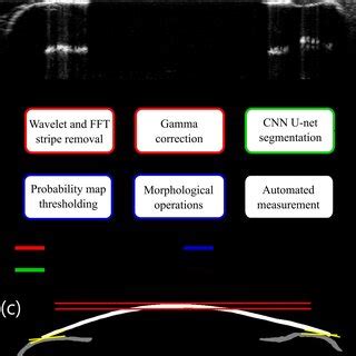 A Raw OCT Scan B General Scheme Of Scan Processing And Download Scientific Diagram