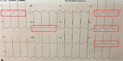 Pain And Strain — Kwak Talk