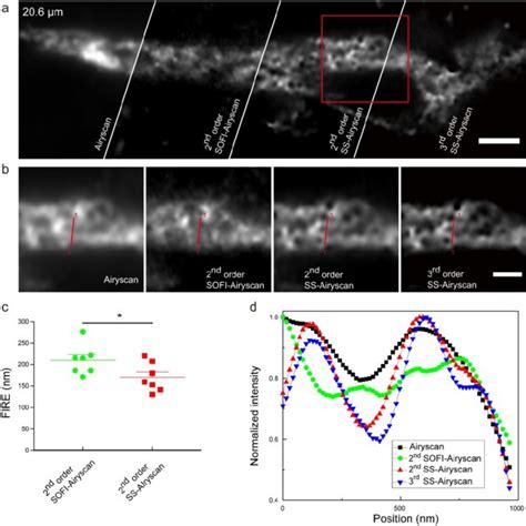Dual Color Imaging Of The Nucleolar Components In Cells By Ss Airyscan