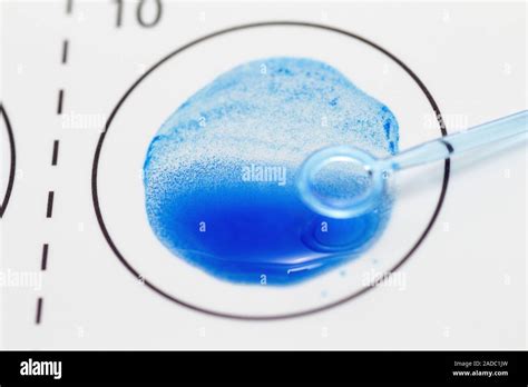 Latex Agglutination Test Close Up Of The Results Of A Latex Agglutination Test Or Assay Also