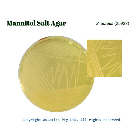 Mannitol Salt Agar Ausamics