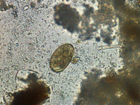 Test Parasite Egg Detection Object Detection Dataset By Research