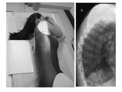 Radiography Positioning Spine Ppt Radiography Positioning Spine Ppt