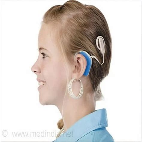 Digital Cochlear Implant Device Behind The Ear Model Namenumber Kanso 2 Sound Processor At