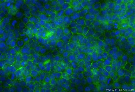 Dpp4 Cd26 Antibody Cl488 84606 6 Proteintech