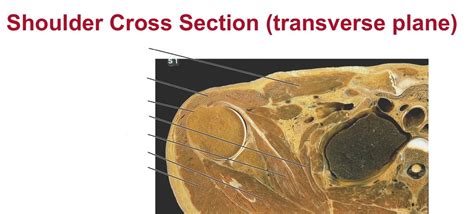 Shoulder Cross Section Transverse Plane Diagram Quizlet