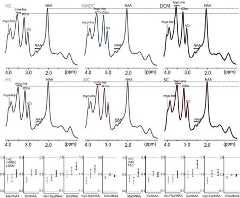 Group Averaged Mr Spectra And Their Quantification In Lcmodel Spectra