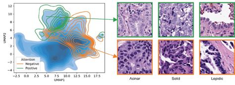 model introspection and umap analysis of learned histological features