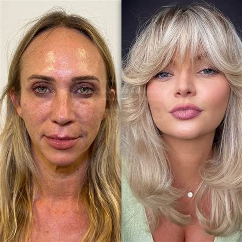 European Board Certified Plastic Surgery In Istanbul The Best Plastic