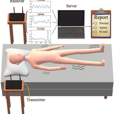 system architecture for contactless sleep apnea and plmd detection