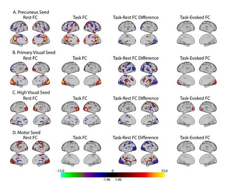 Seed Based Fc Findings Seed Based Functional Connectivity P