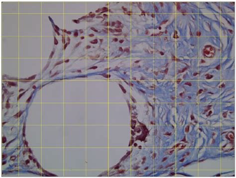 Stereological Quantification Using A Standard Grid Of 33 × 33 µm² With