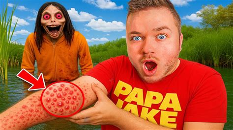 The Creepy Stranger Bit Me Whats Happening To My Body Youtube