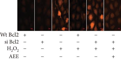 Genetic Inhibition Of Bcl Reduced The Effect Of Aee On H O Induced Download Scientific