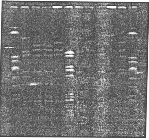 Smai Macrorestriction Patterns Of S Haemolyticus Separated By Pfge Download Scientific