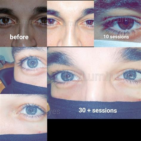 Clinical Photo Archive Illustrative Lumineyes