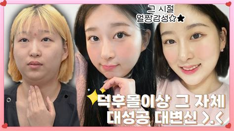당디당 Vlog 분명 달라졌는데 어디가 달라졌지👀 눈 코 턱 묘하게 더 이뻐지는 과정 Vlog Youtube