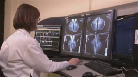 First Time In 20 Years Fda Proposing New Mammogram Guidelines Fox 5 Dc