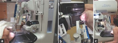 Tomosynthesis Guided Core Biopsy Of The Breast Why And How To Use It